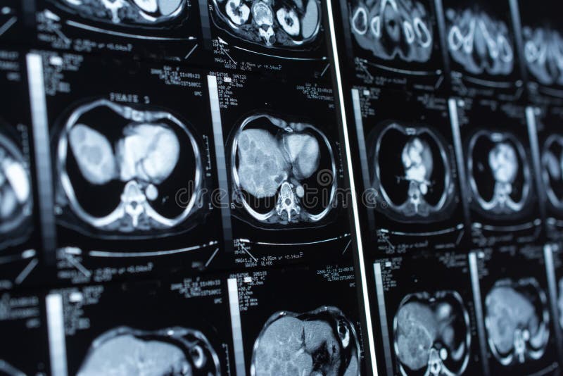 Research in Medicine. CT Scan of the Patient Stock Photo - Image of ...