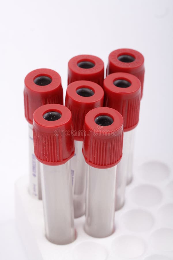 Research test tubes stock photo. Image of laboratory, hospital - 4809806