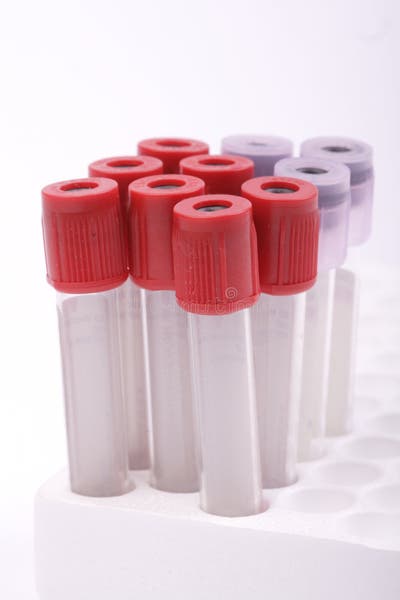 Research test tubes stock photo. Image of cancer, health - 4810066