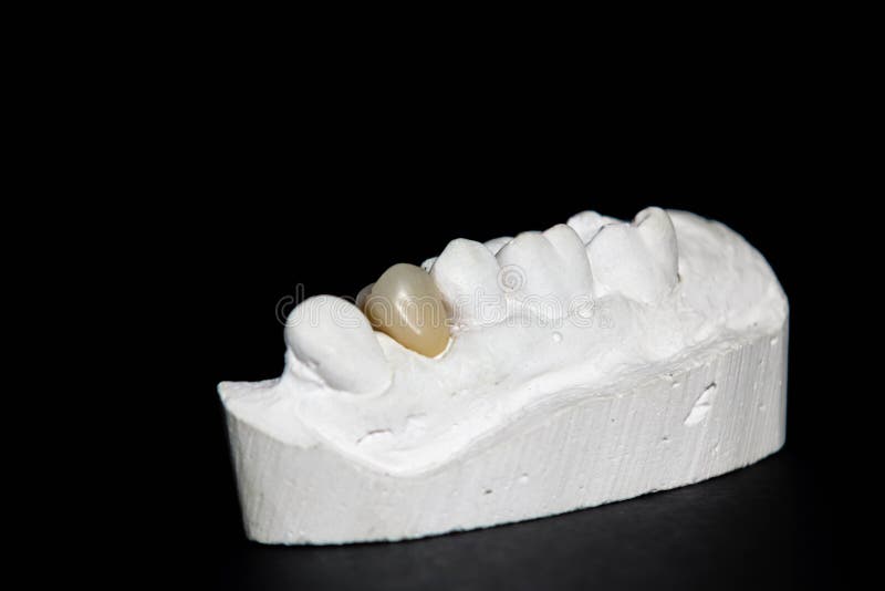 Resin tooth stock photo. Image of plaster, medicine, technician - 44648938
