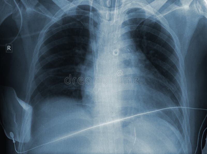 Result of an X-ray Examination Stock Image - Image of exam, diagnostics ...