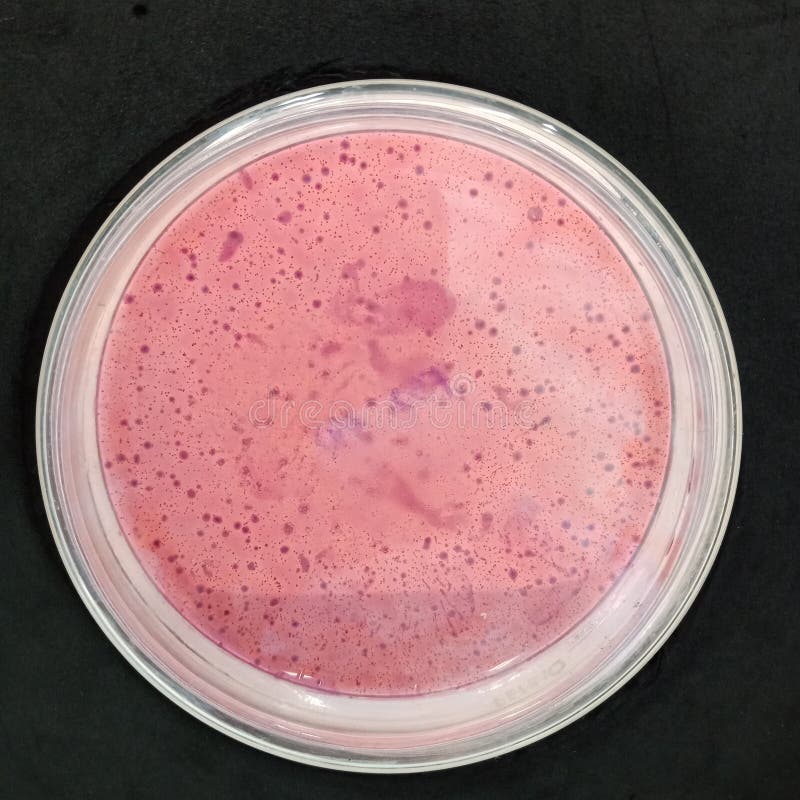 Isolation of Coliform Bacteria from Samples of Chicken Organs Infected ...