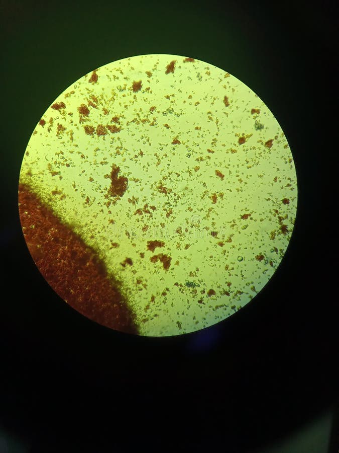Results of Observations of Animal Cells & X28;human Blood& X29; Using a ...