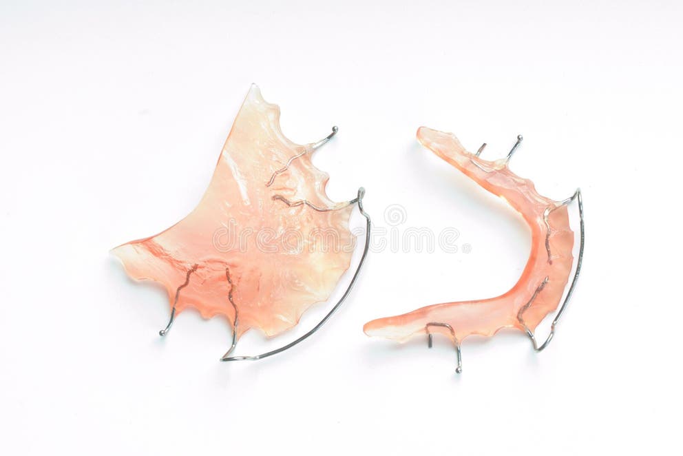 Retainer stock photo. Image of molded, removable, retainer - 18866606