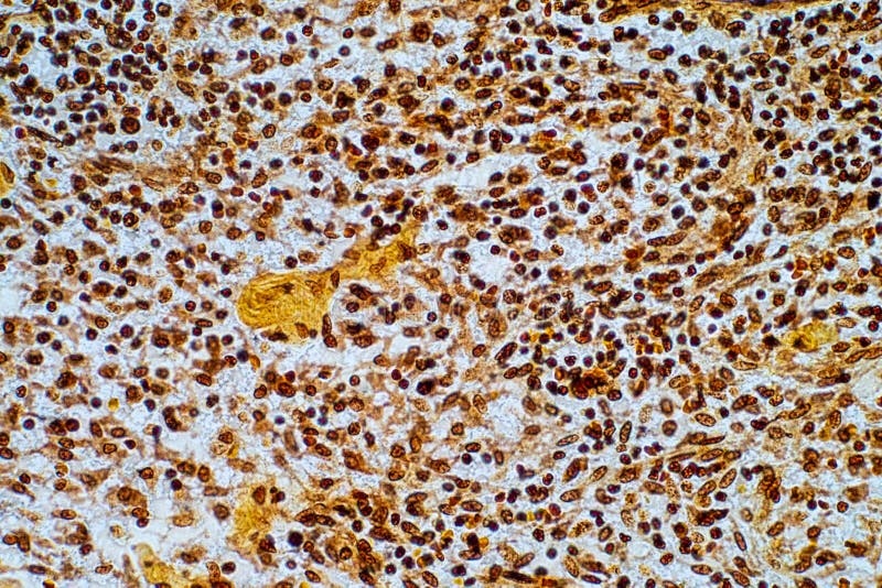 Reticular Tissue Spleen