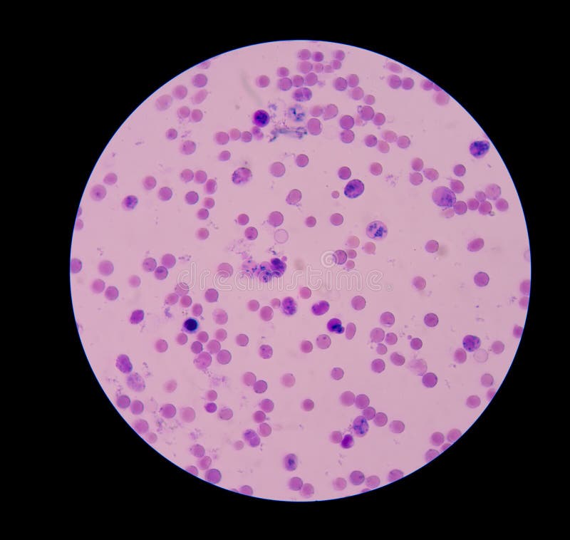 Reticulocyte stock photo. Image of erythrocytes, medicine - 90279428