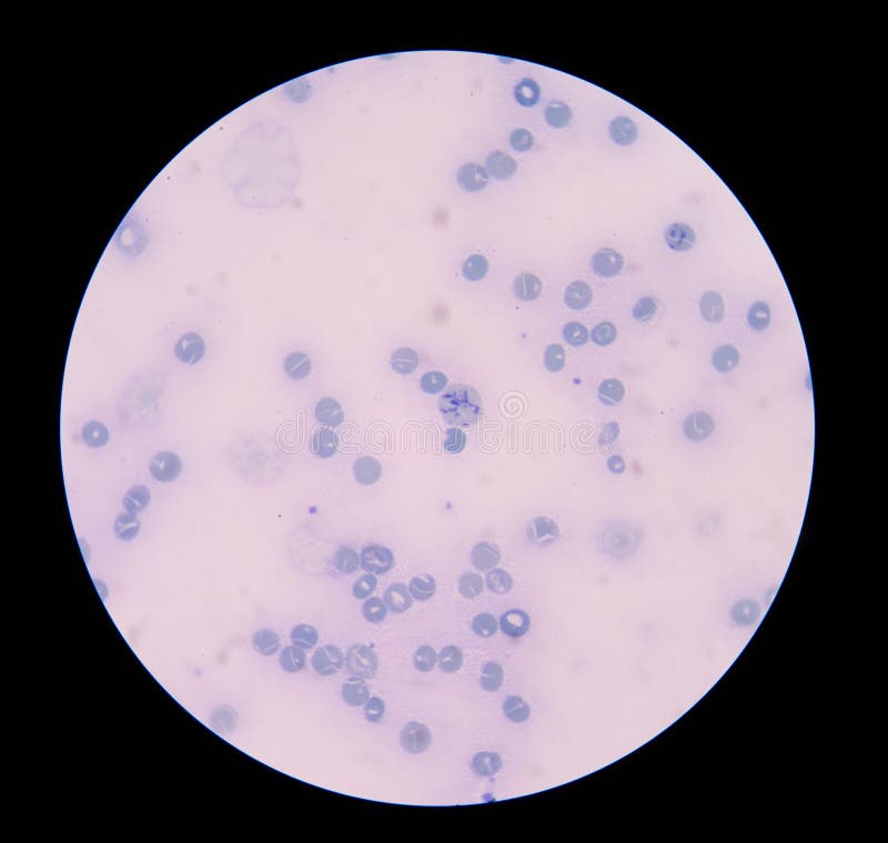 Reticulocytes stock image. Image of deficiency, human - 67925771