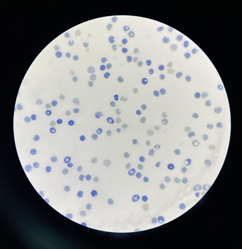 Reticulocytes are Red Blood Cells that are Still Developing Stock Photo ...