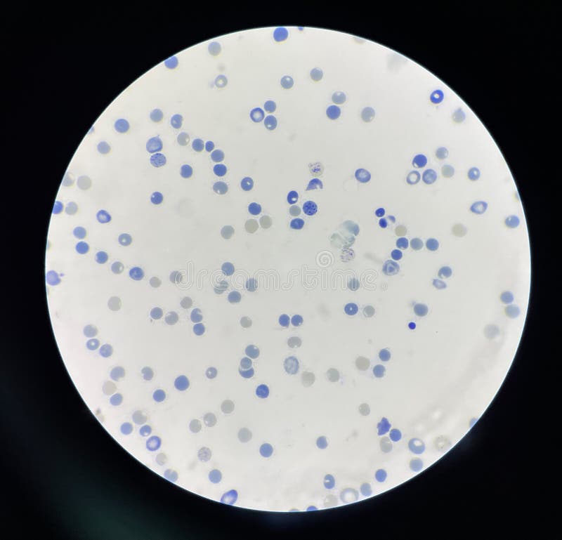 Reticulocytes are Red Blood Cells that are Still Developing Stock Image ...