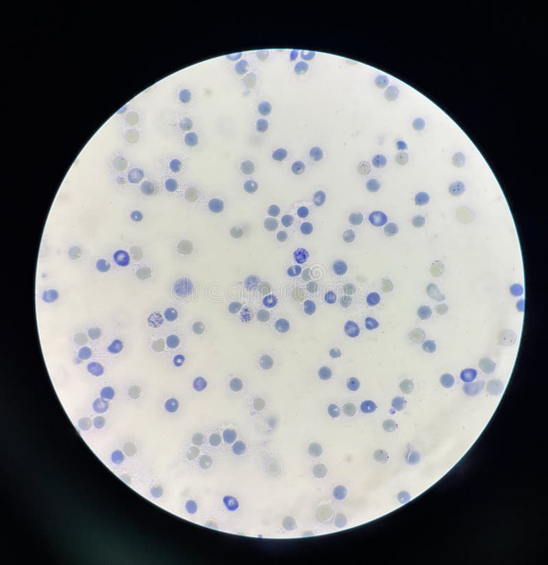 Reticulocytes are Red Blood Cells that are Still Developing Stock Image ...