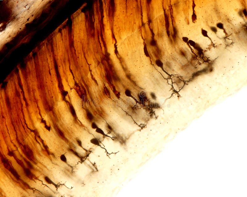 Retina. Golgi Method. Amacrine Cell Stock Image - Image of microscopy ...