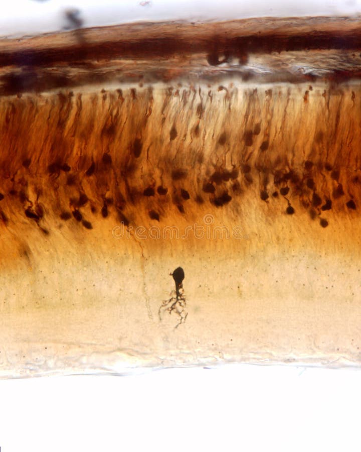 Retina. Golgi Method. Amacrine Cell Stock Photo - Image of amacrine ...
