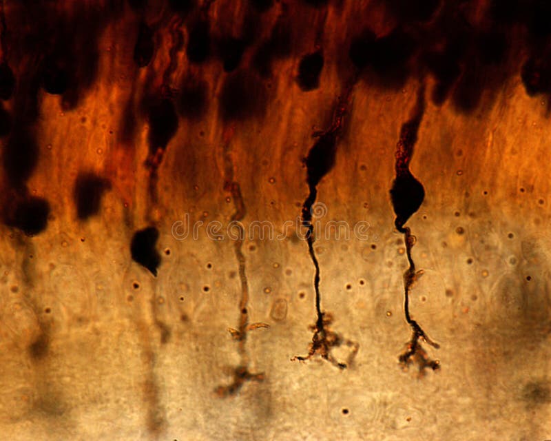 Retina. Golgi Method. Bipolar Cells Stock Image - Image of microscope ...