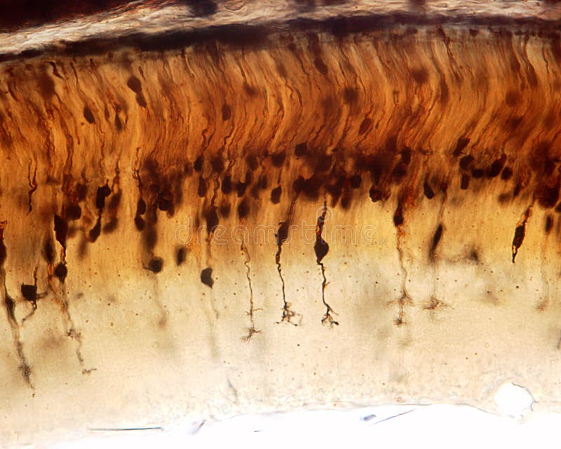 Retina. Golgi Method. Bipolar Cells Stock Image - Image of plexiform ...
