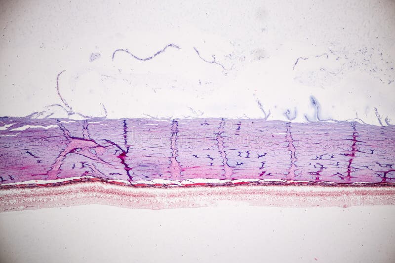 Retina Human Under Microscope. Stock Photo - Image of eyeball, healthy ...