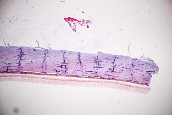 Retina Human Under Microscope. Stock Photo - Image of microscope ...