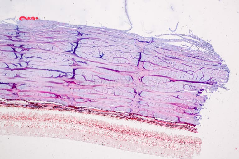 Retina Human Under Microscope. Stock Photo - Image of medicine, human ...