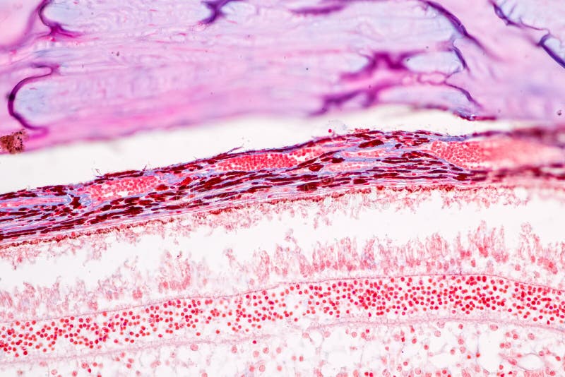 Retina Human Under Microscope. Stock Photo - Image of duct, eyeball ...