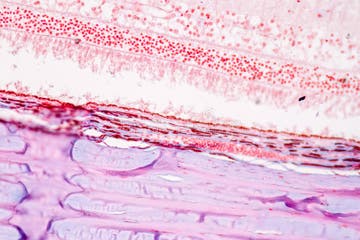 Retina Human Under Microscope. Stock Photo - Image of duct, eyeball ...