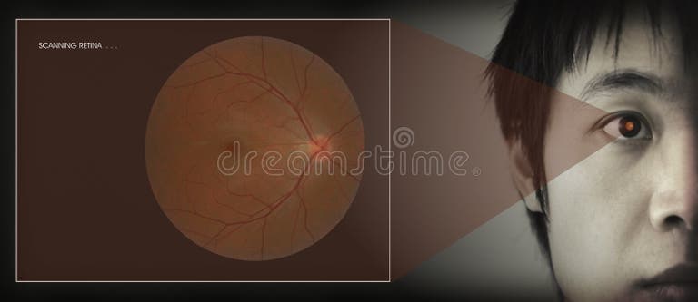 Retinal Scan stock image. Image of health, ophthalmologist - 5549367
