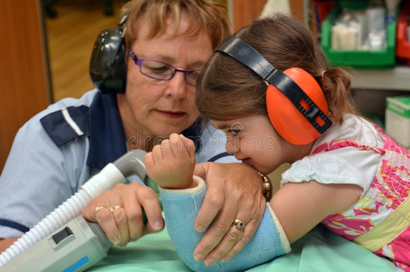 Retiro del molde imagen editorial. Imagen de salud, vendaje - 39387375