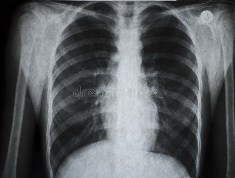 Retrato do raio X imagem de stock. Imagem de retrato - 12124085