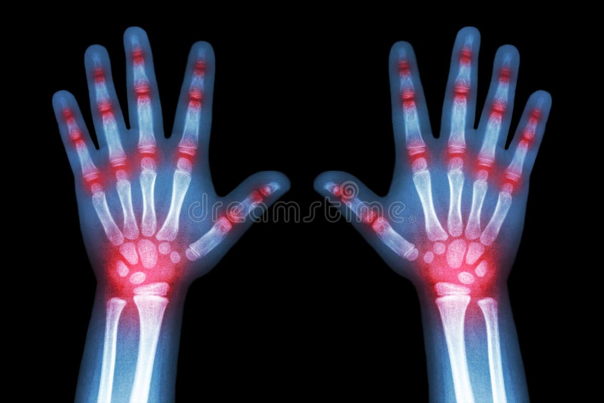 315 Multiple Sick People Stock Photos - Free & Royalty-Free Stock ...