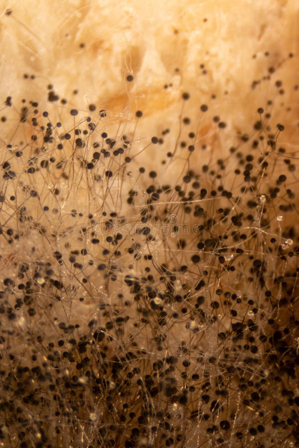 Rhizopus Bread Mold Is A Genus Of Common Saprophytic Fungi,Rhizopus ...
