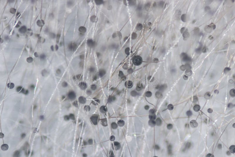 Rhizopus Mold On Bread