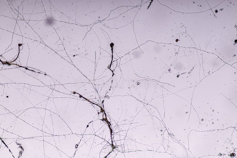 Rhizopus is a Genus of Common Saprophytic Fungi on Slide Under the ...