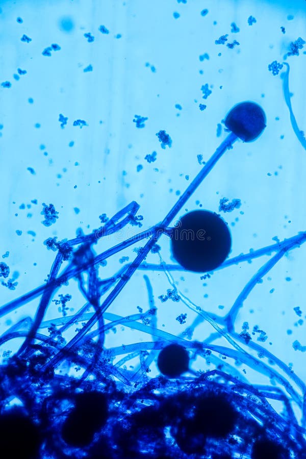 Rhizopus is a Genus of Common Saprophytic Fungi on Slide Under the ...