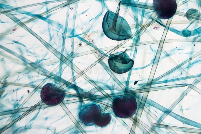 Svampar Under Mikroskopisk SiktsAspergillus Svamp Mikrobiologi ...