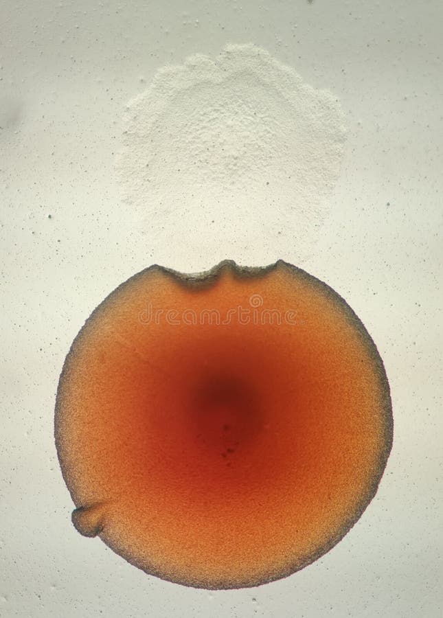 Rhodotorula Colony Under the Microscope Stock Photo - Image of colonies ...