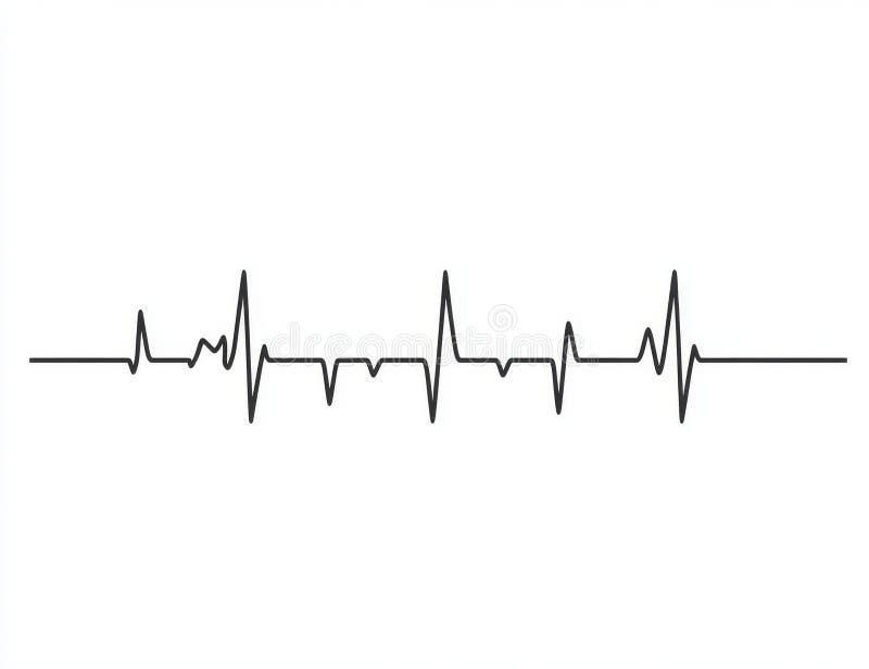 The Rhythm Line Graph of an Electrocardiogram, or ECG, Shows the ...
