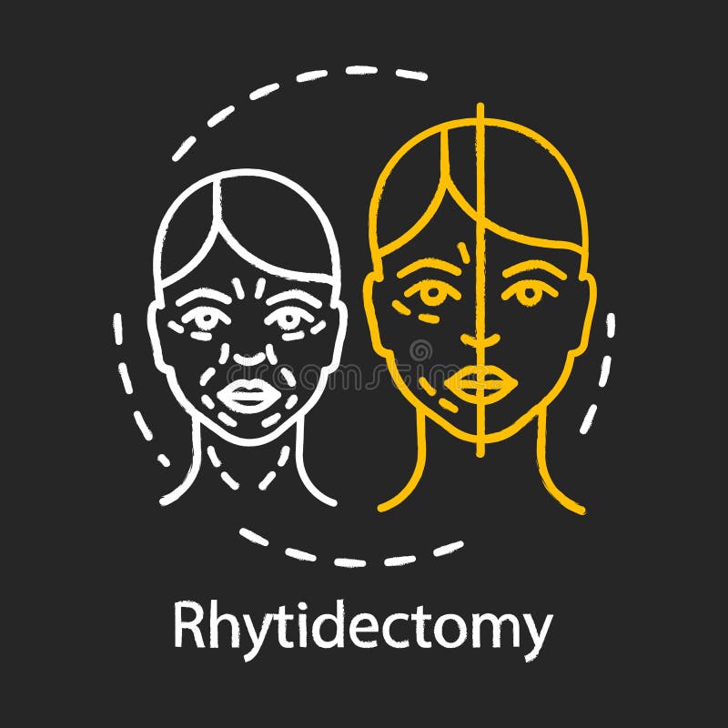 Rhytidectomy chalk icon stock vector. Illustration of beauty - 176290694 Rhytidectomy chalk icon stock vector. Illustration of beauty - 176290694