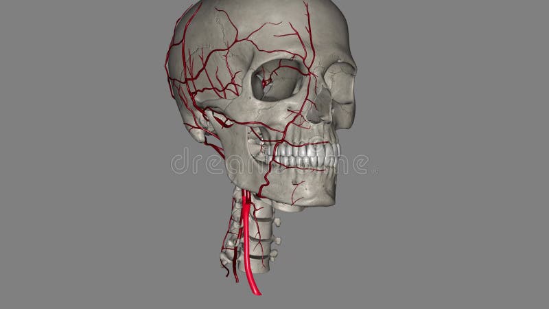 Right Common Carotid Artery Stock Footage - Video of bicuspid, right ...
