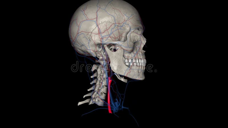 Right Common Carotid Artery Stock Footage - Video of bicuspid, right ...