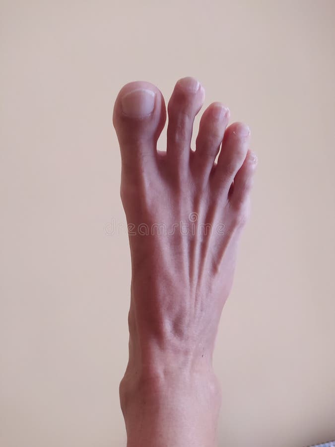 The Right Foot Muscles in the Old Book the Human Anatomy Basics, by a ...