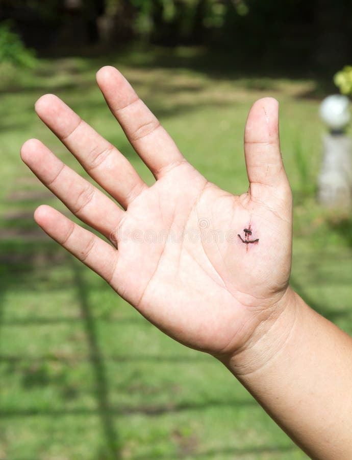 Right hand injury. stock image. Image of nurse, isolated - 46800993