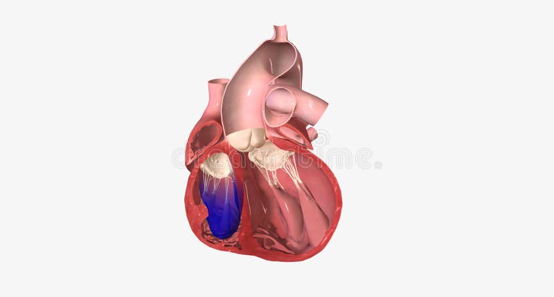 Right-sided Heart Failure is Commonly Caused by Left-sided Heart ...