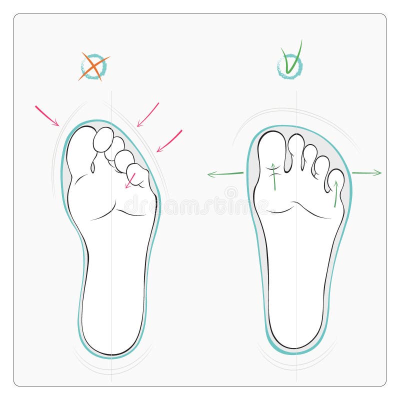 Right Wrong Shoes, Barefoot, Healthy Feet, Vector Illustration Stock ...