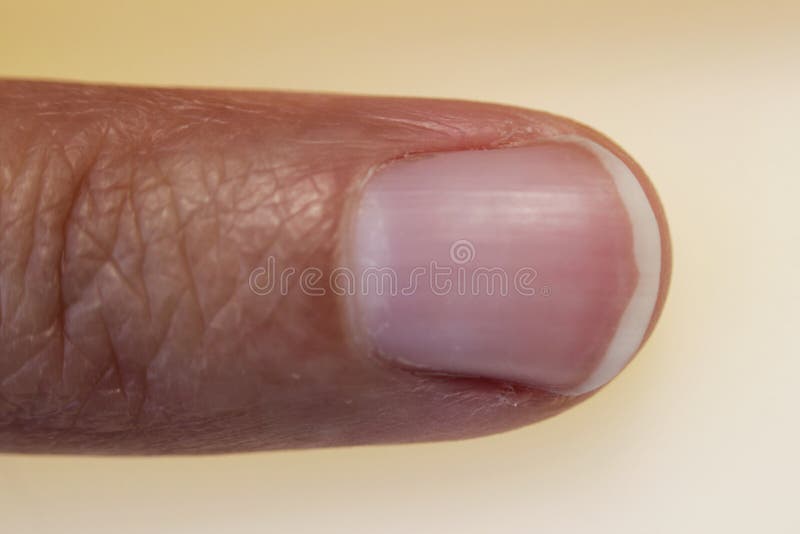 Ring Finger of the Female with a Nail without a Manicure, Macro Stock ...