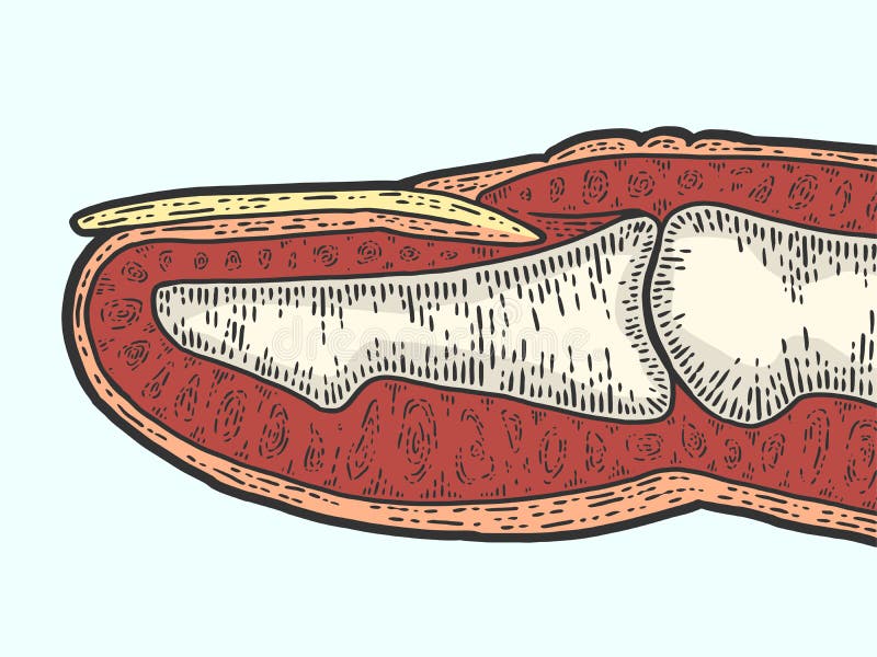 Anatomische Kleur. Structuur Knie Gewrichtsvectorschets Krasbord ...