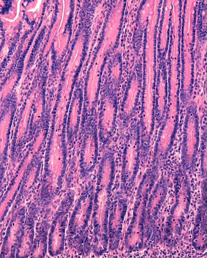 Rinnovamento Di Epitelio Intestinale Mitosi Immagine Stock - Immagine ...