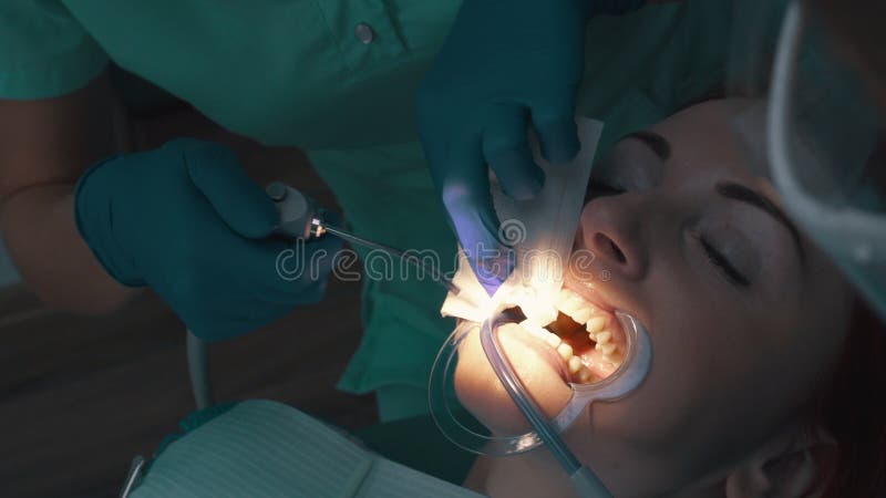 Rinse Enamel Surface with Water Using Washer after Ultrasonic Cleaning ...