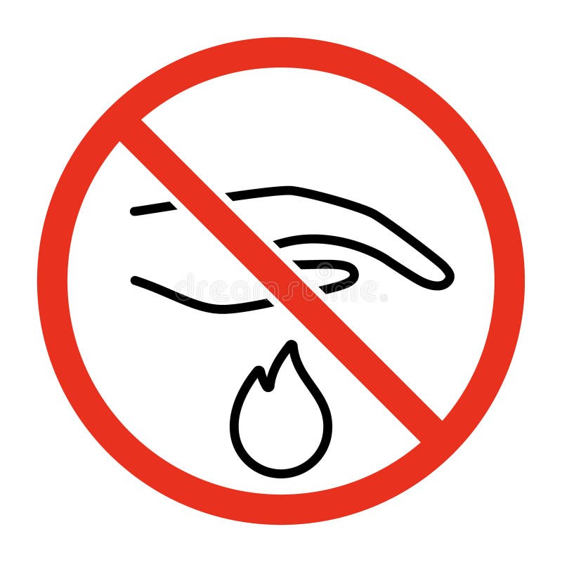 Burn of Hand Human Skin. First Aid for Fire or Chemical Injury Skin ...