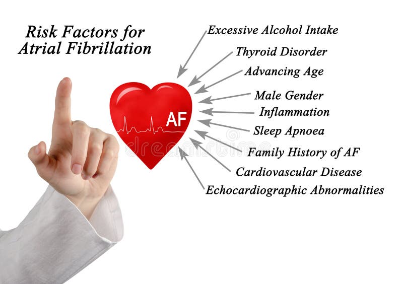 Risk Factors for Atrial Fibrillation Stock Image - Image of disease ...