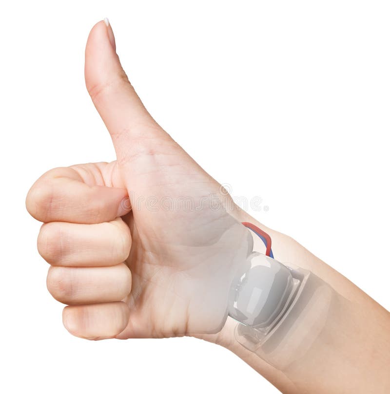 Roboterhand Innerhalb Der Menschlichen Hand Handprothesenkonzept ...