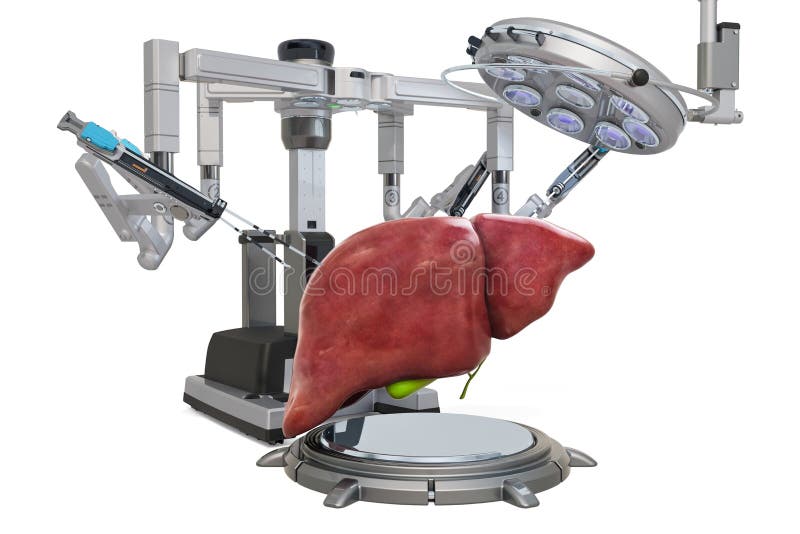 Robotic Surgery of the Liver Concept, 3D Rendering Stock Illustration ...