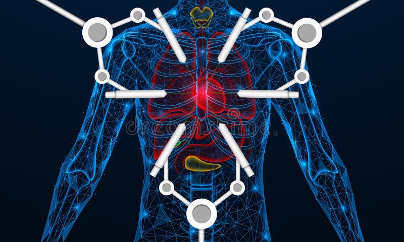 Robotic Surgical System, Heart Surgery. Stock Illustration ...
